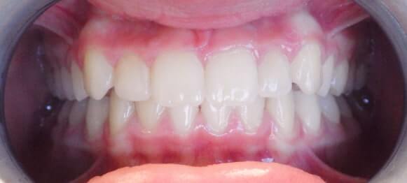 ToothPillow | Changing lives overnight | TOOTHPILLOW