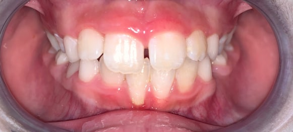 ToothPillow | Changing lives overnight | TOOTHPILLOW