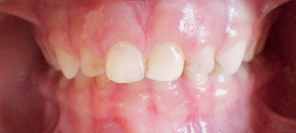 ToothPillow | Changing lives overnight | TOOTHPILLOW